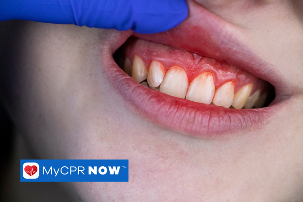 Unseen Dangers: Dealing with Internal Bleeding